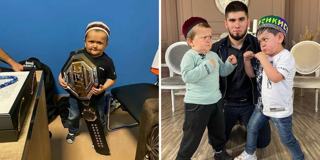 The Internet is Obsessed with Hasbulla & Here's the Backstory | Local ...